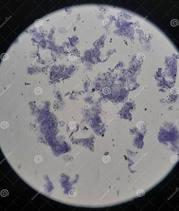 Epithelial Cells of Human Oral Cavity Under the Microscope Stock Photo ...