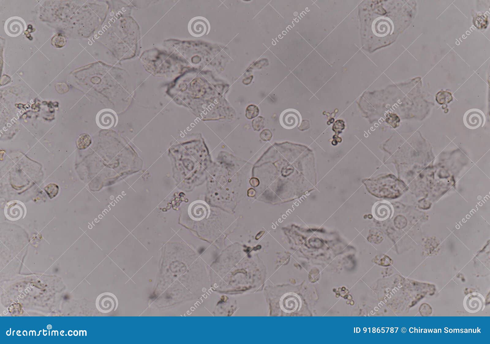 Epithelial Tissue with Bacteria Cells Yeast Cells Stock Image - Image ...