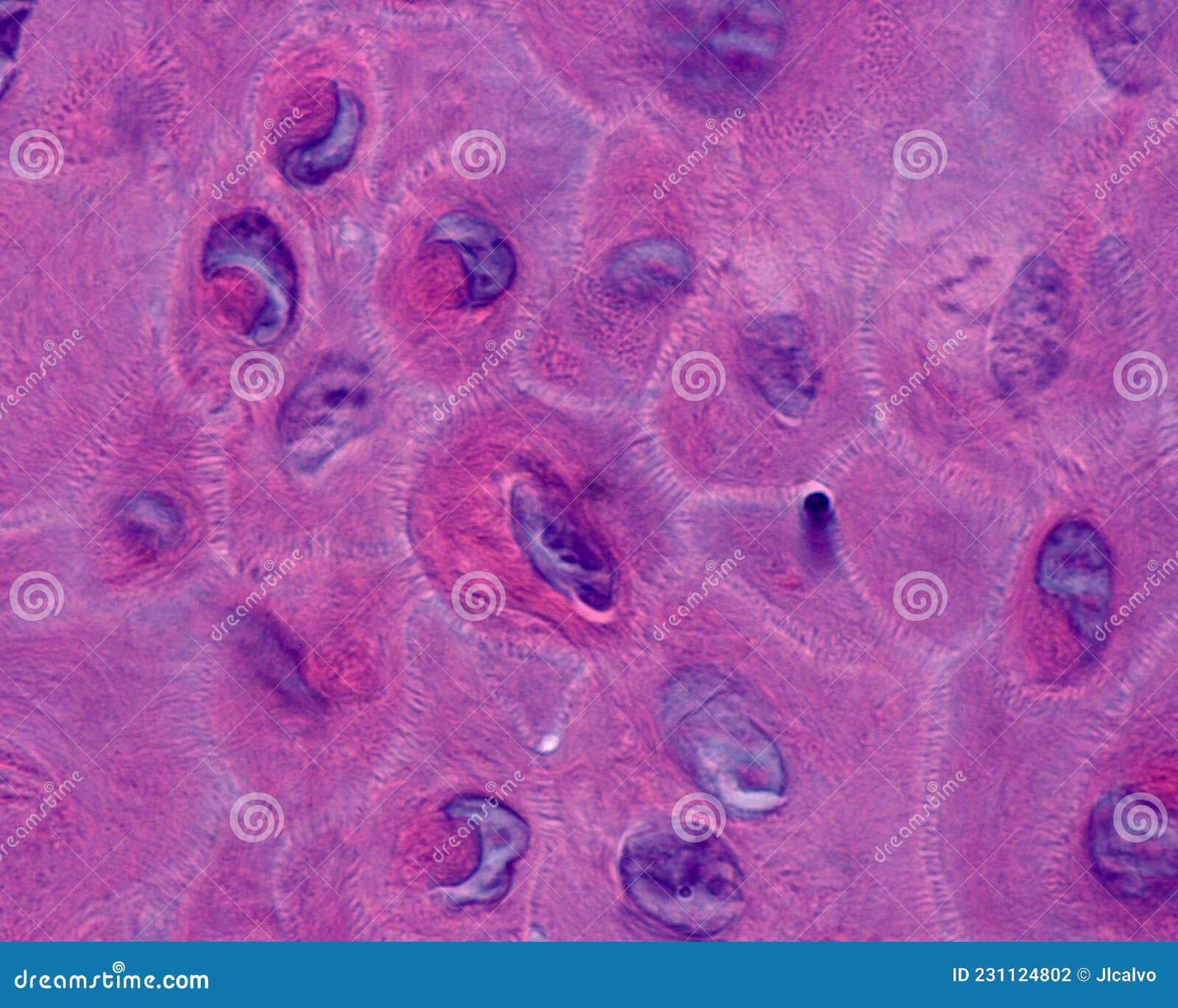 Human Skin. Epidermis. Hyperkeratosis Stock Photo - Image of microscope ...