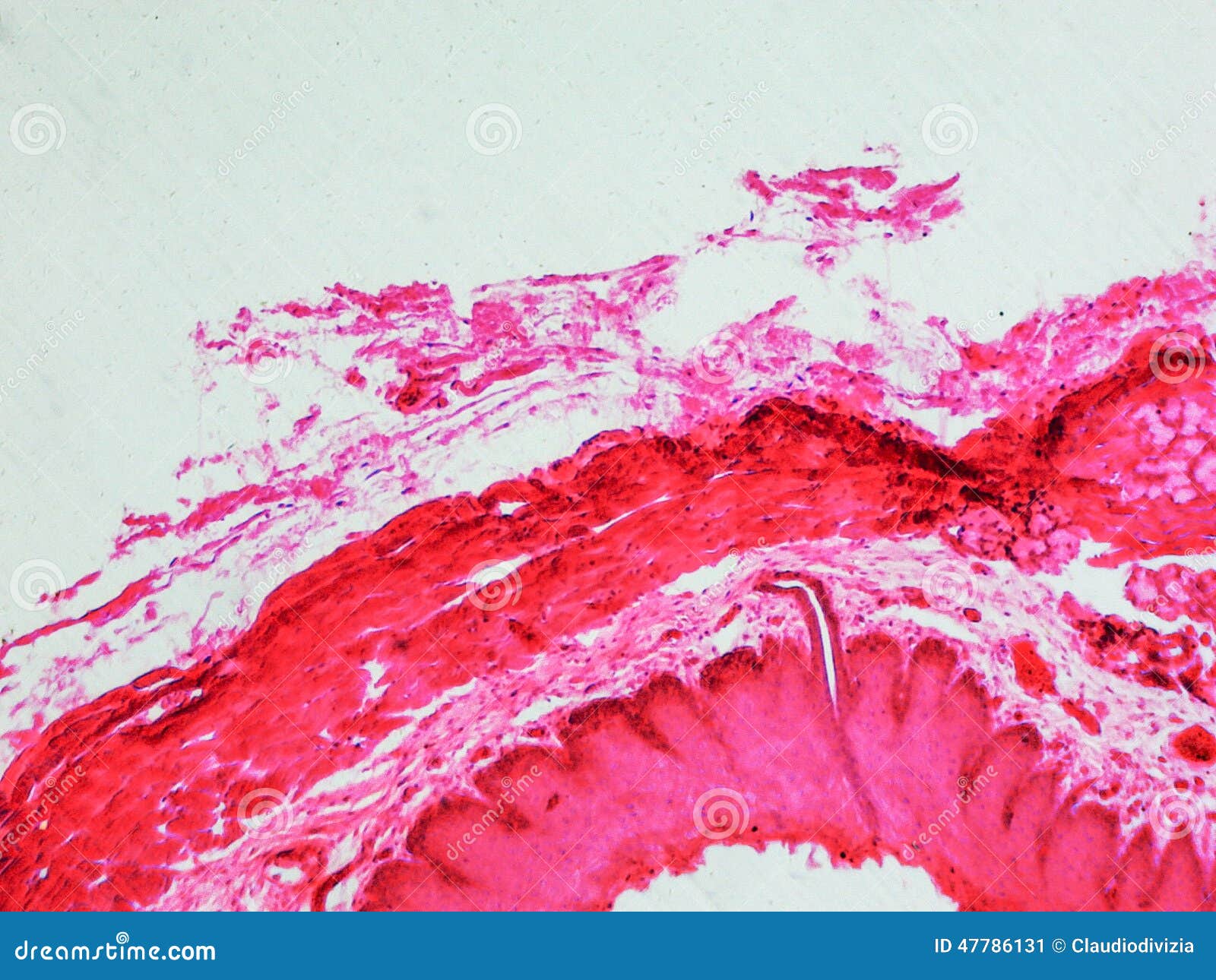 Epithelium micrograph stock image. Image of macro, detail - 47786131