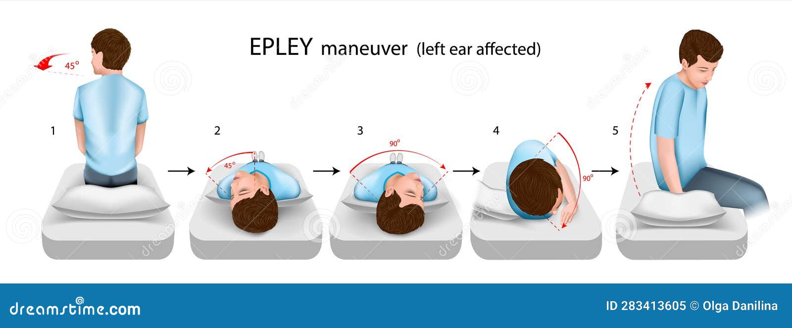 Epley Maneuver Left Ear Affected Vector Illustration Stock Vector ... Epley Maneuver Left Ear Affected Vector Illustration Stock Vector ...