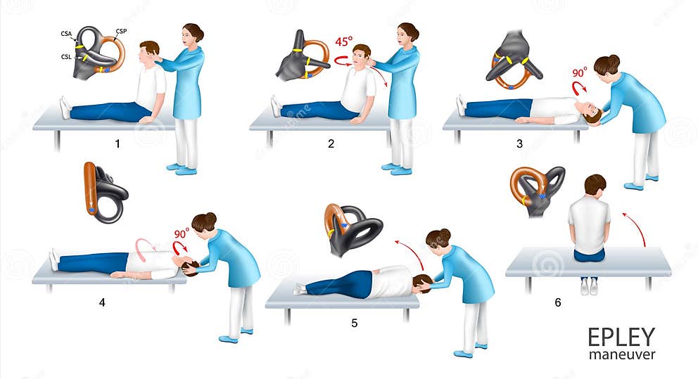 Epley Maneuver is Performed Help of a Doctor Stock Vector ...