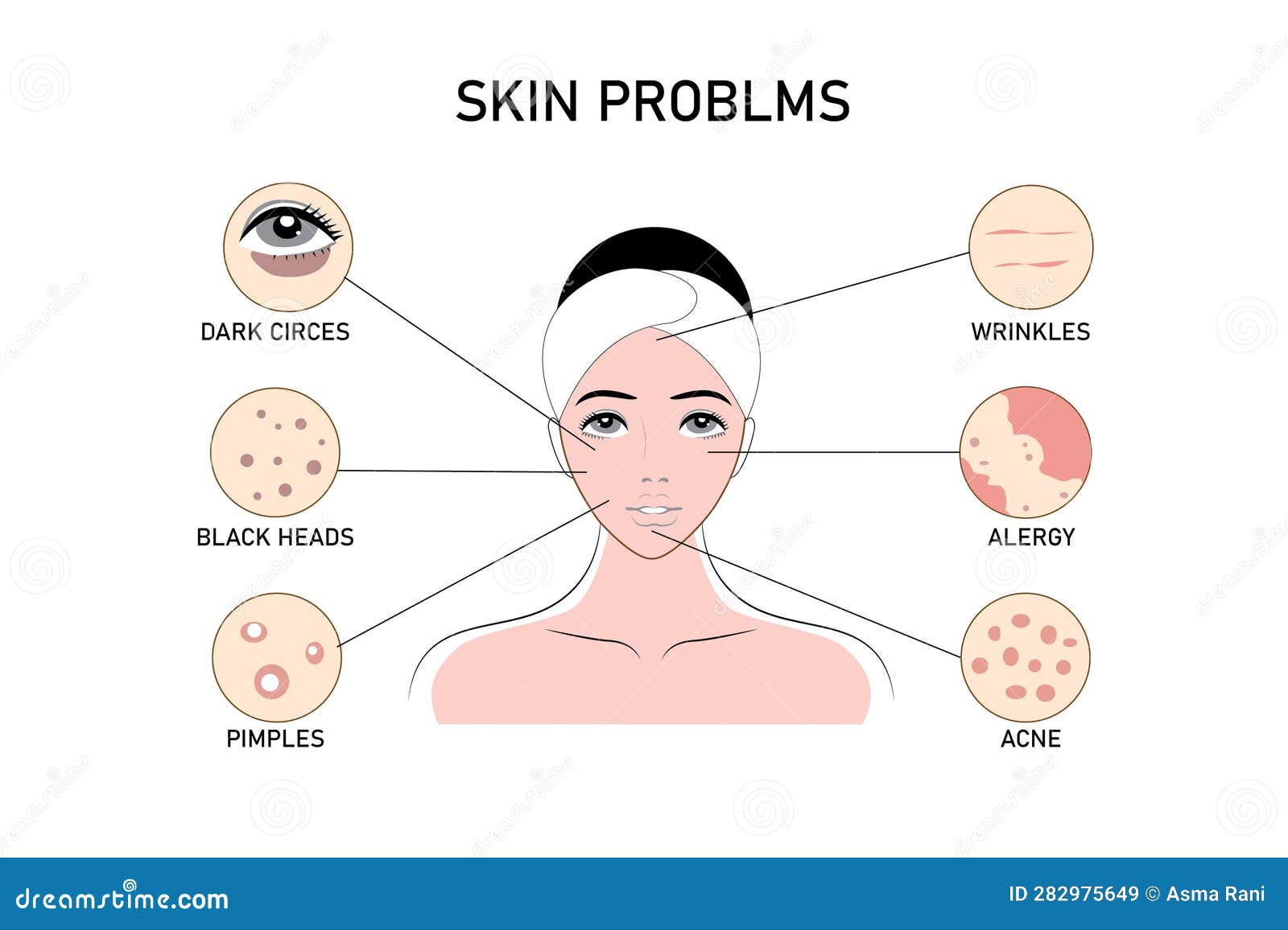 Skin Problems. Acne, Dark Circles, Black Heads, Pimple, Allergy ...
