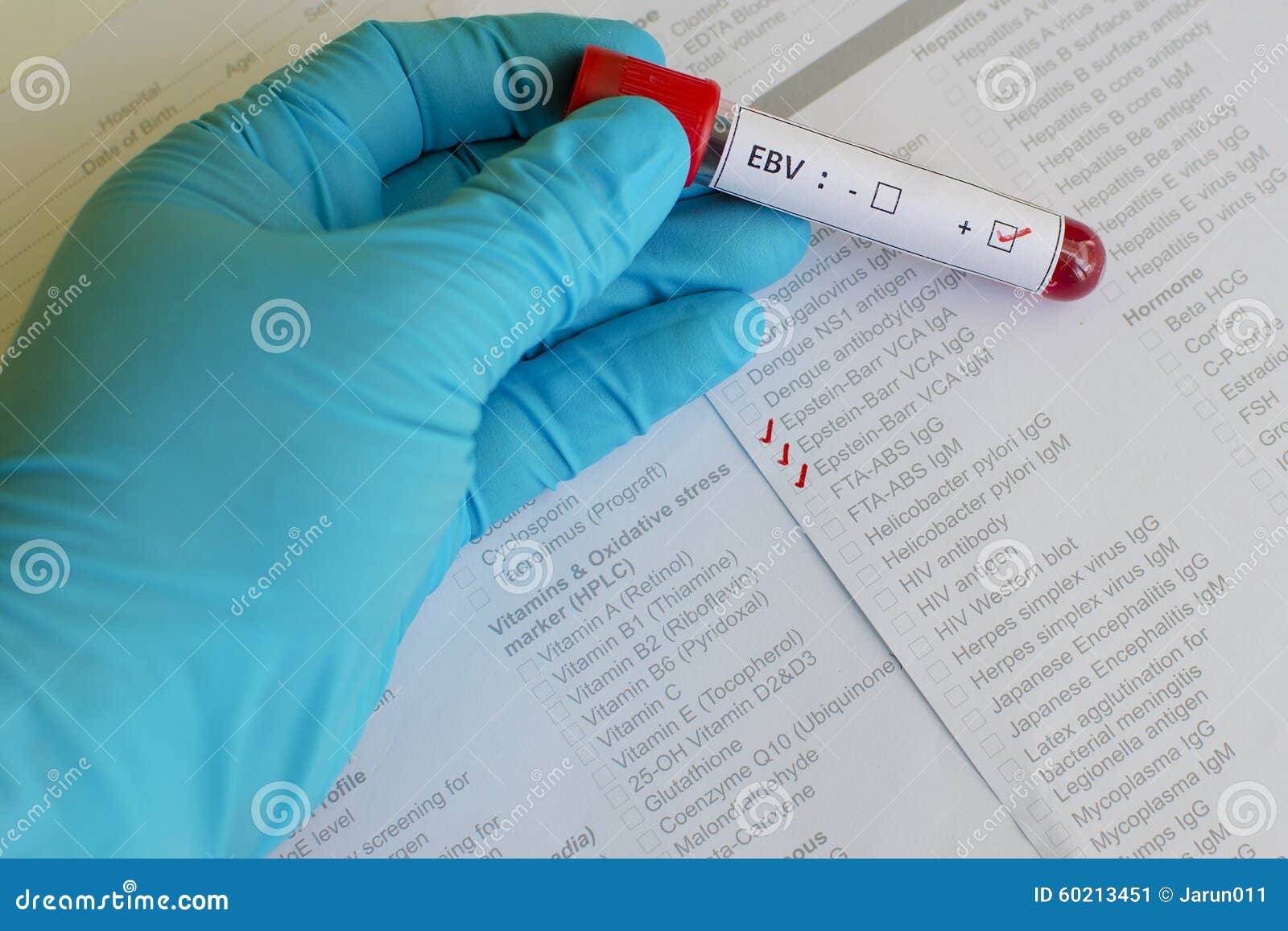 Epstein-Barr virus (EBV) stock image. Image of epstein - 60213451