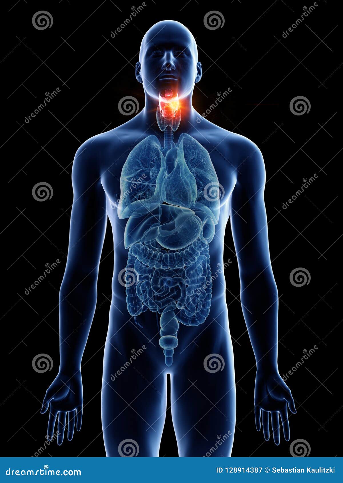 Equipaggia Il Cancro Della Laringe Illustrazione di Stock ...