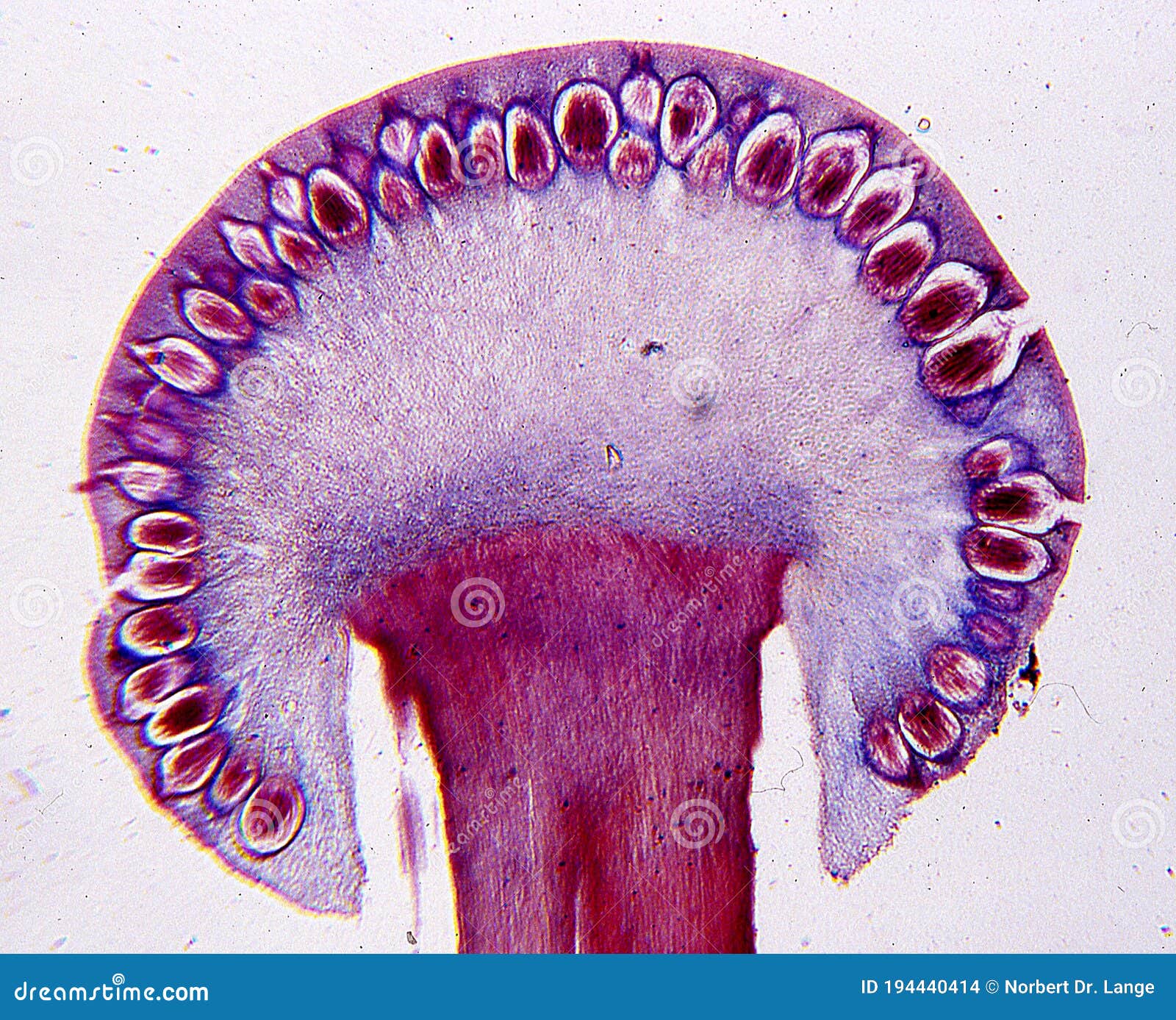 Ergot Mushroom in Longitudinal Section Stock Photo - Image of pest ...