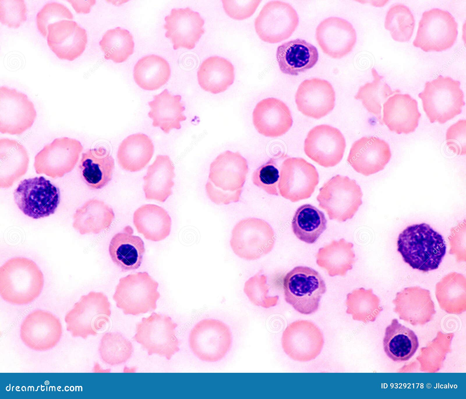 Erythroblasten Blutausstrich Stockfoto - Bild von embryo, gewebelehre ...