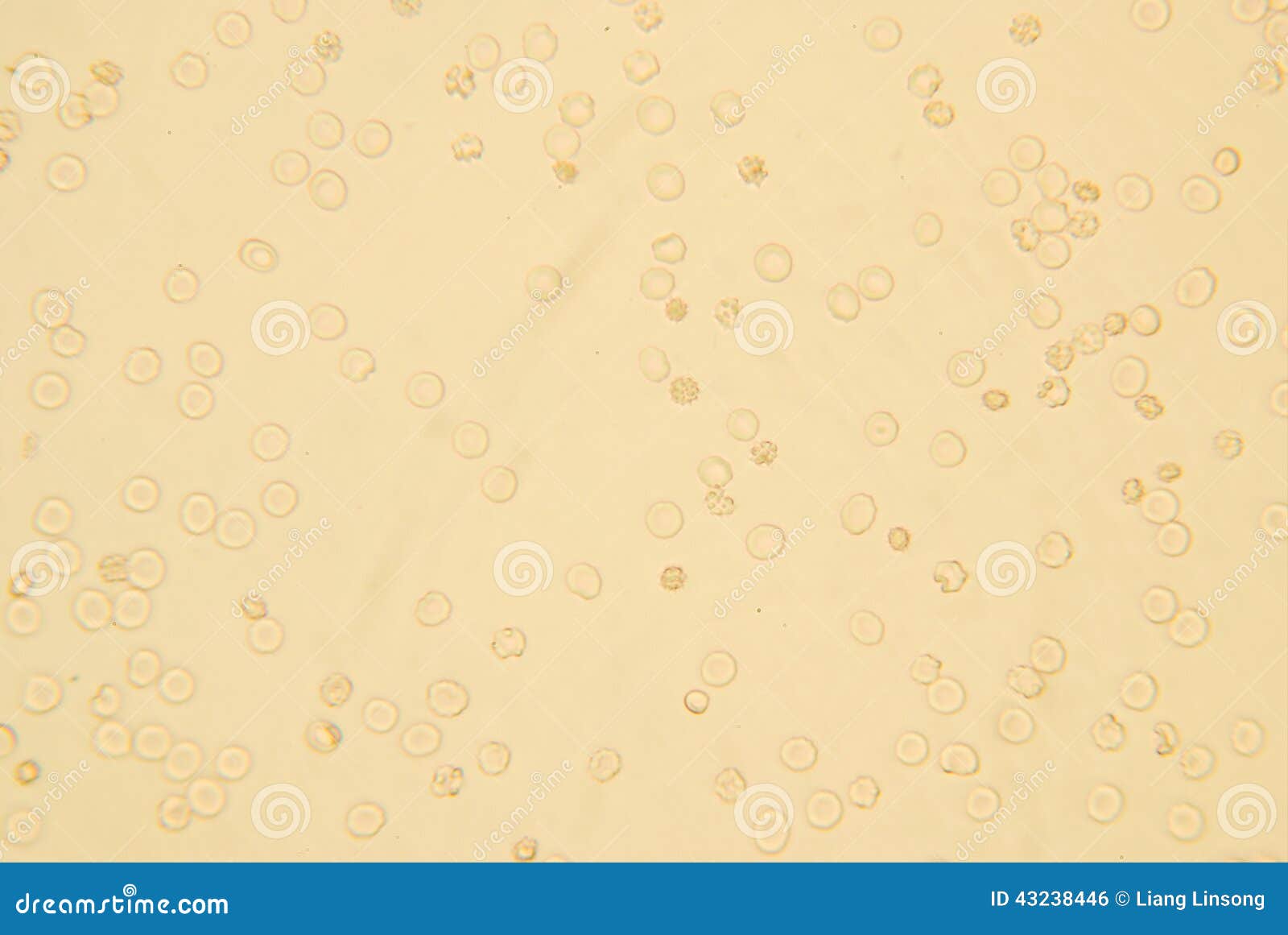 Erythrocytic Cells and Inclusions Stock Photo - Image of inclusions ...
