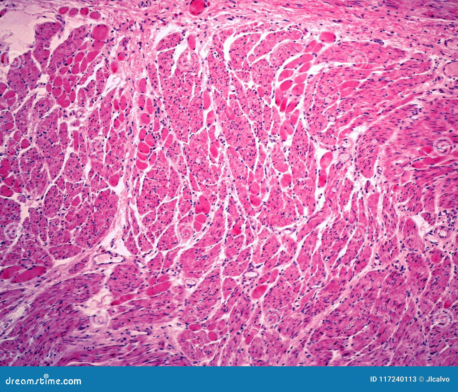 Esófago Capa del músculo imagen de archivo. Imagen de microscopia ...
