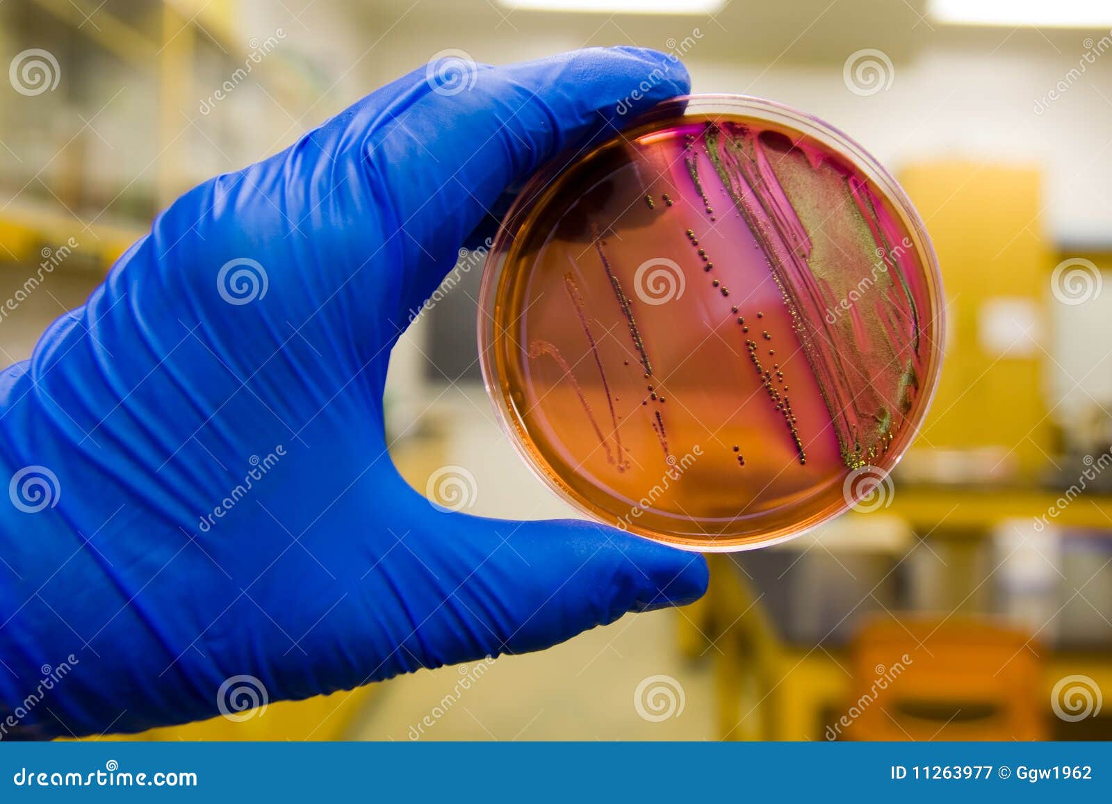 Escherichia Coli E.coli Cultured With Eosin Methylene Blue EMB Agar In ...