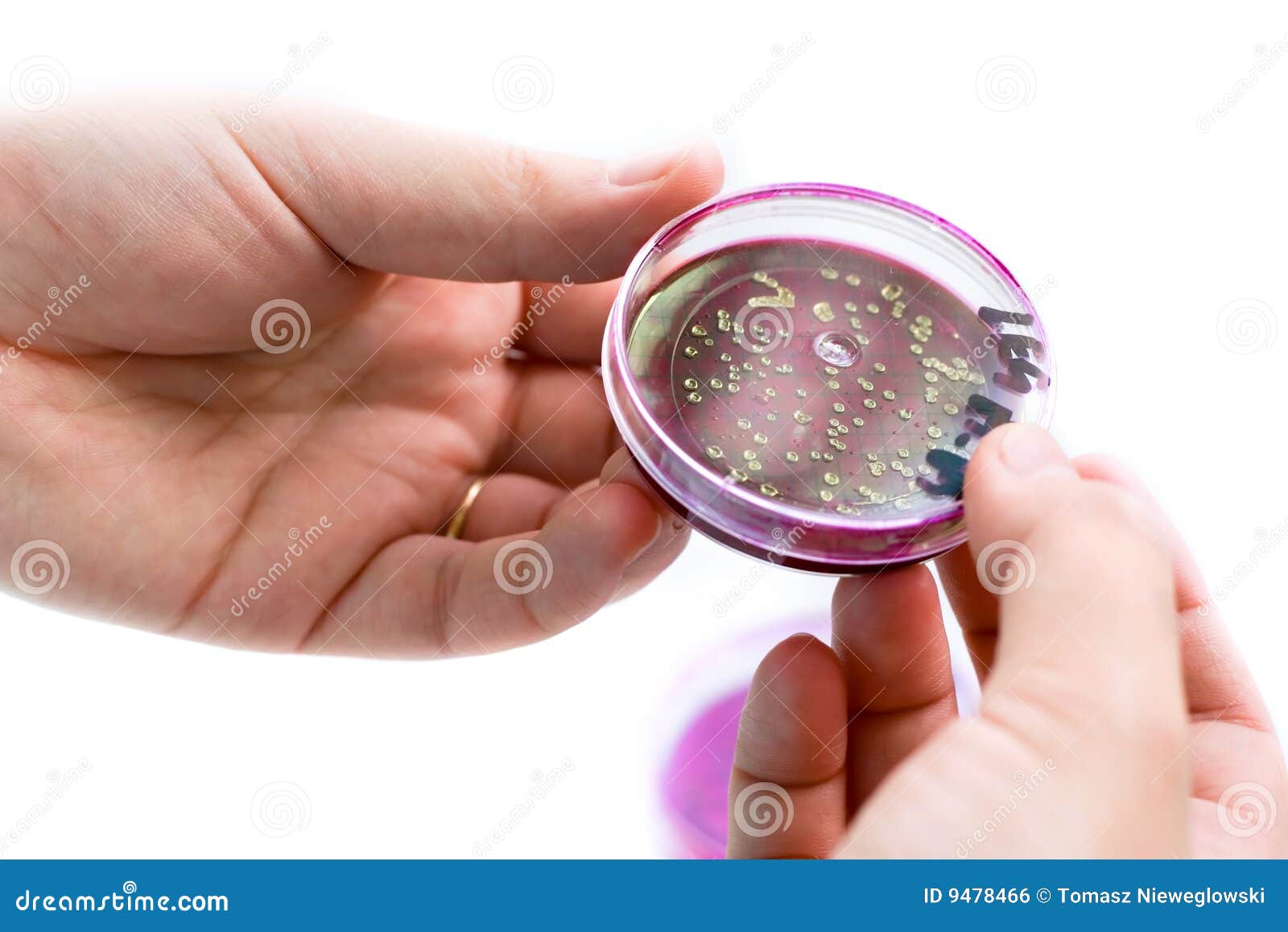 Escherichia coli photo stock. Image du inspection, laboratoire - 9478466