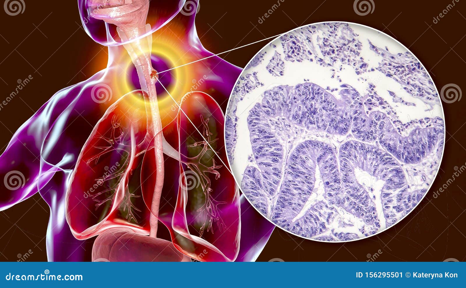 Micrograph Cartoons, Illustrations & Vector Stock Images - 3533 ...