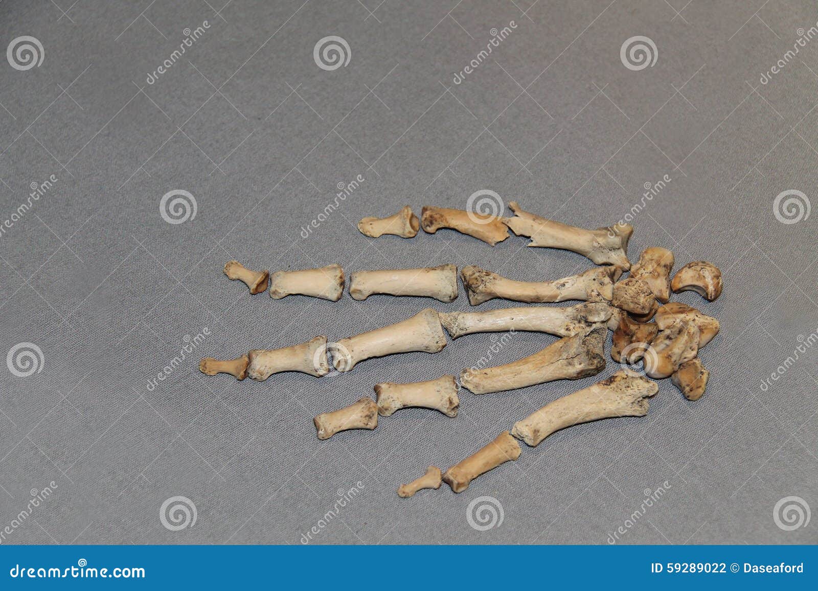 Esqueleto Humano De La Mano Foto de archivo - Imagen de esqueleto ...