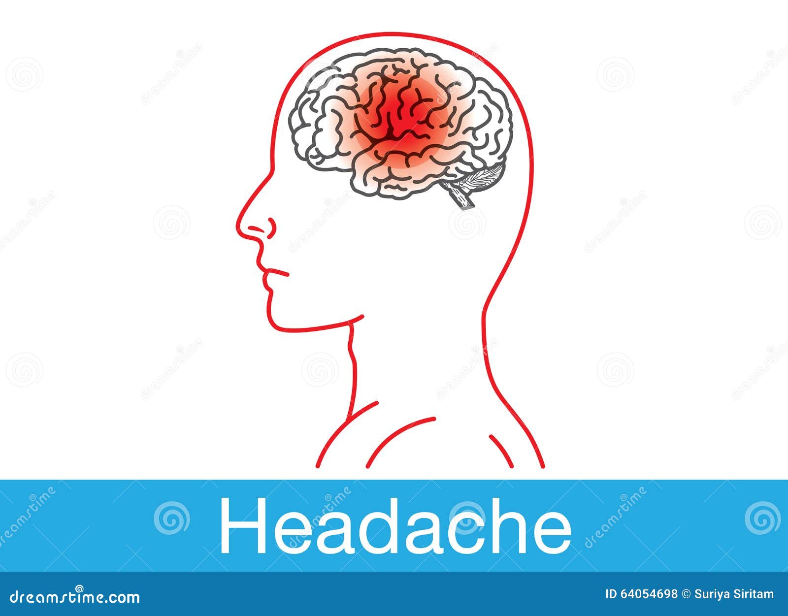 Esquema Del Dolor De Cabeza Ilustración del Vector - Ilustración de ...