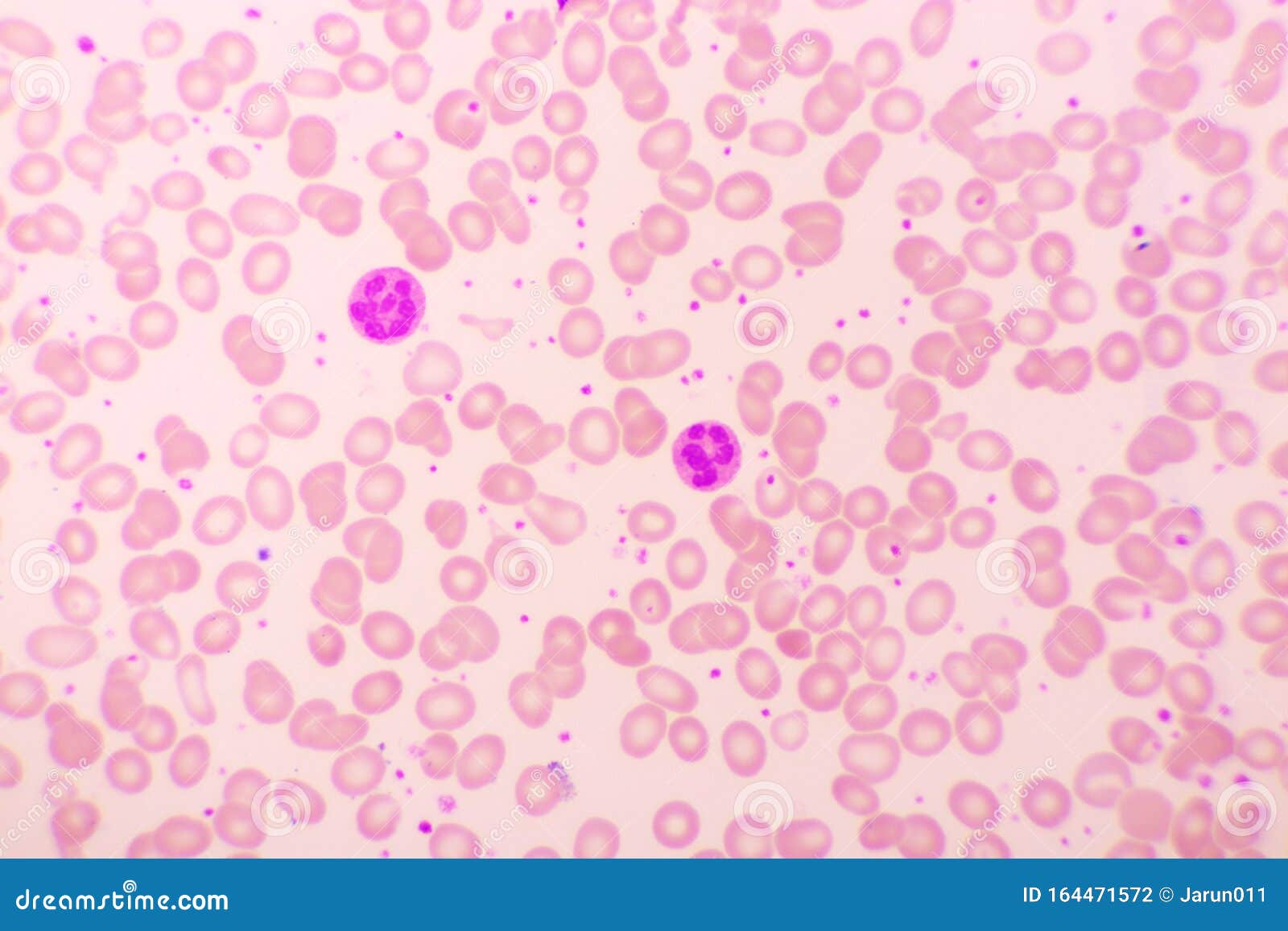 Blood Smear Under Microscope Is Showing Normal Red Blood Cell. Stock ...