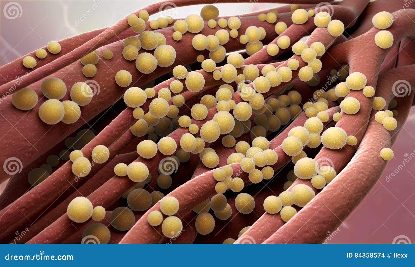 Estafilococo - áureo ilustração stock. Ilustração de micro - 84358574