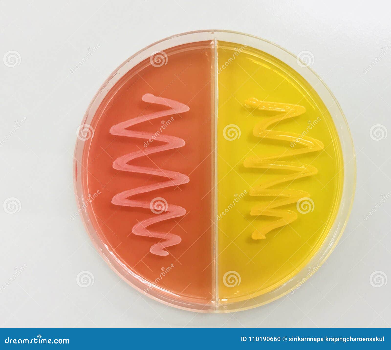 Estafilococo En Agar De La Sal Del Manitol Foto de archivo - Imagen de ...