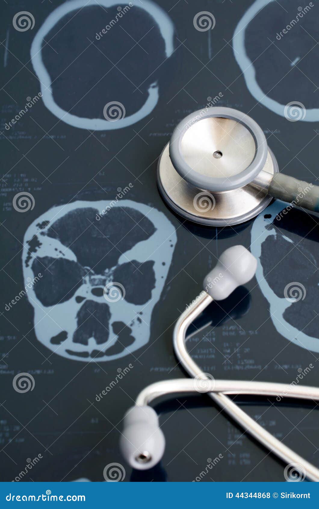 Estetoscopio gris foto de archivo. Imagen de pulso, espacio - 44344868