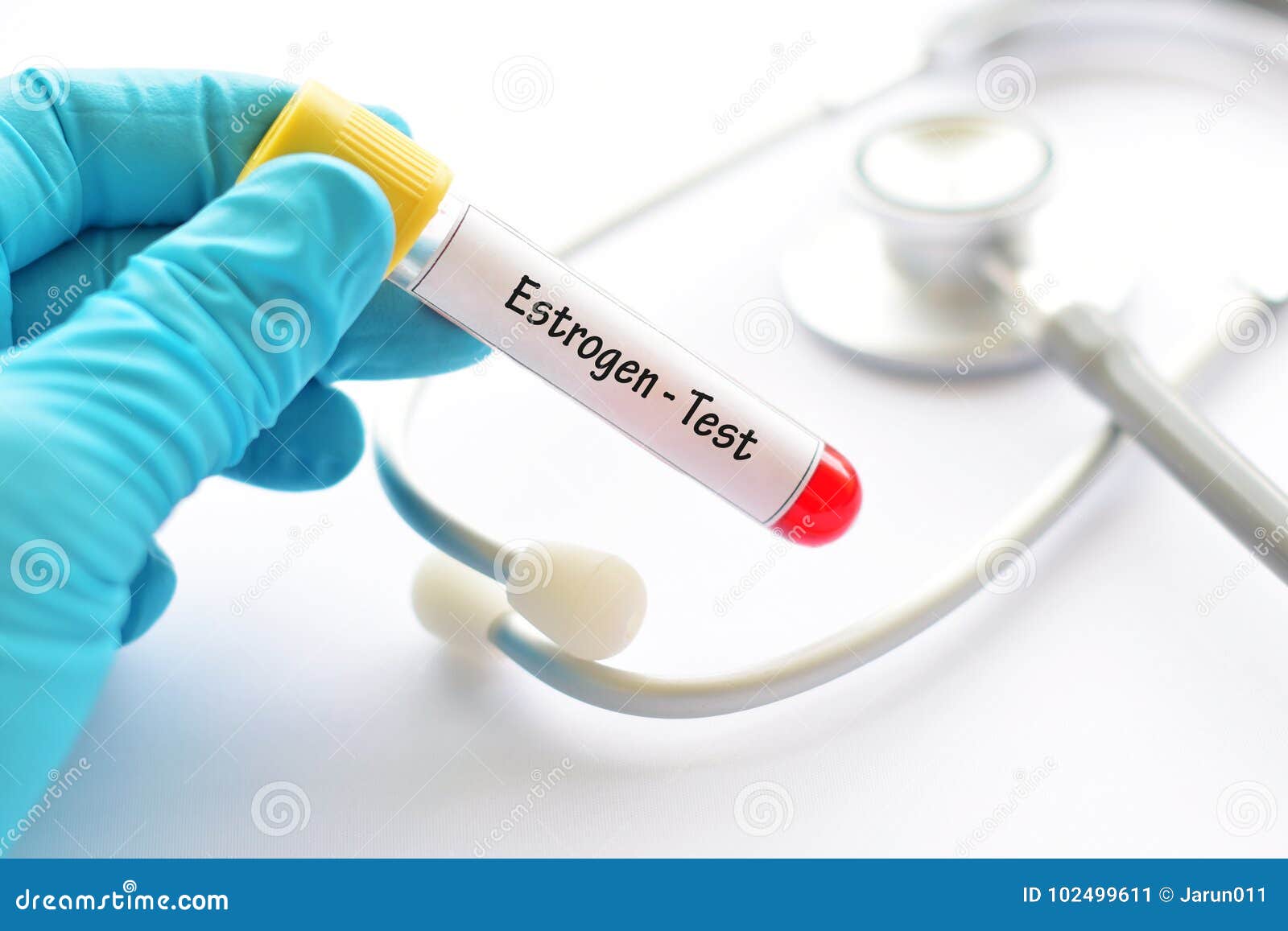 Estrogen hormone test stock image. Image of care, hematology - 102499611
