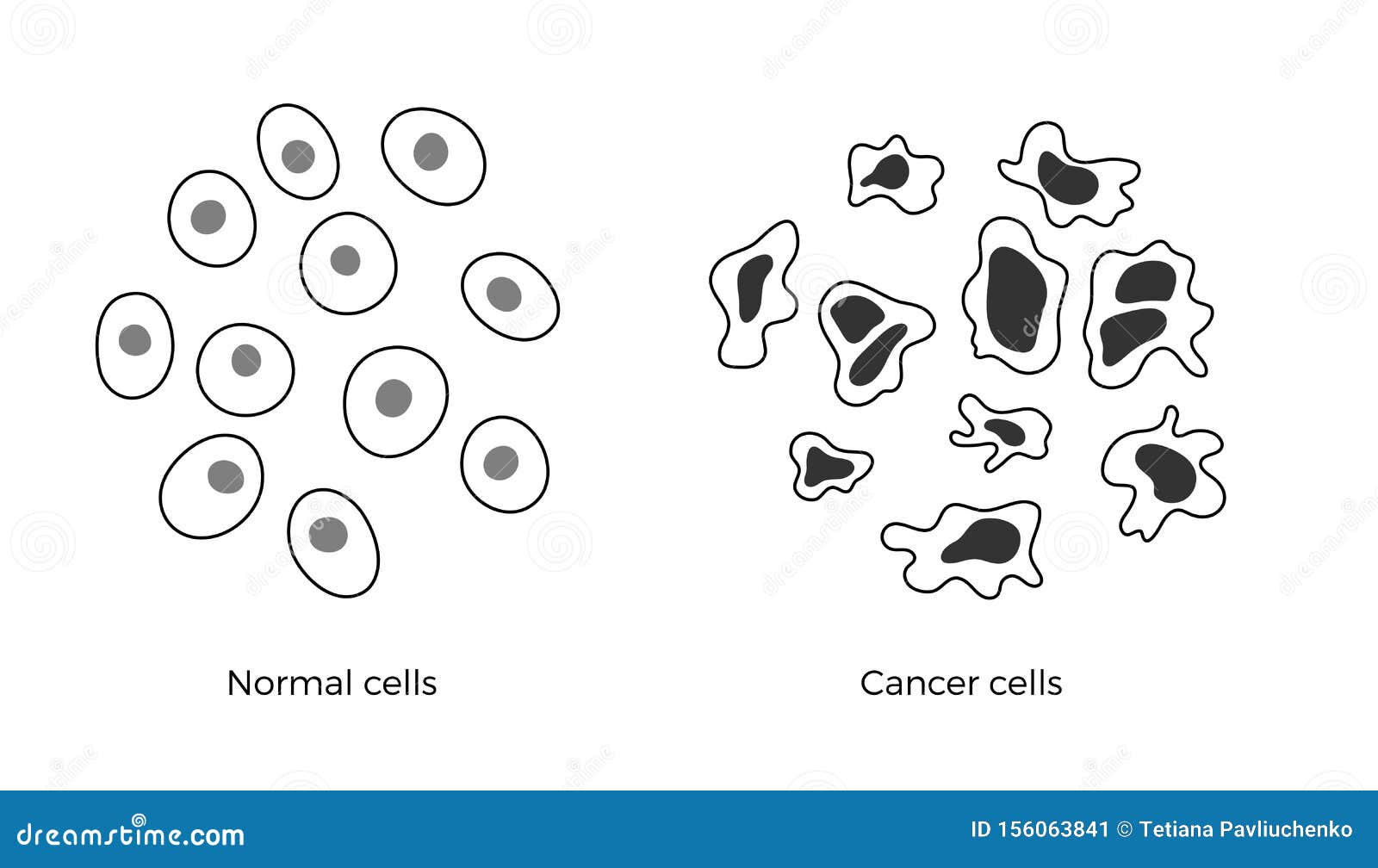 Estructura De Celdas: Normal Y CÃ¡ncer Ilustración del Vector ...