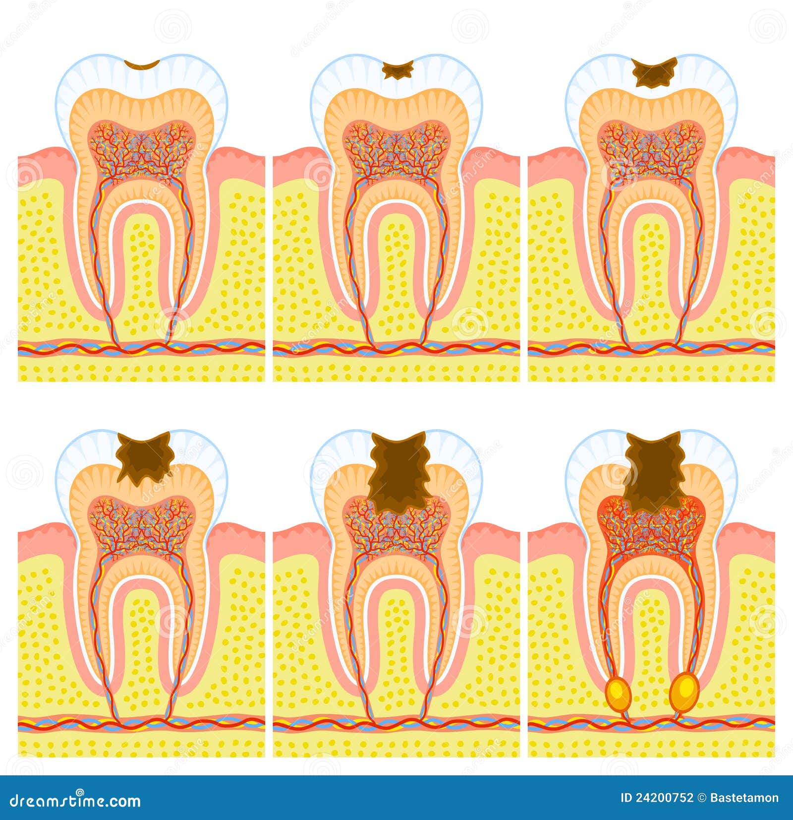 Estructura Interna Del Diente Ilustración del Vector - Ilustración de ...