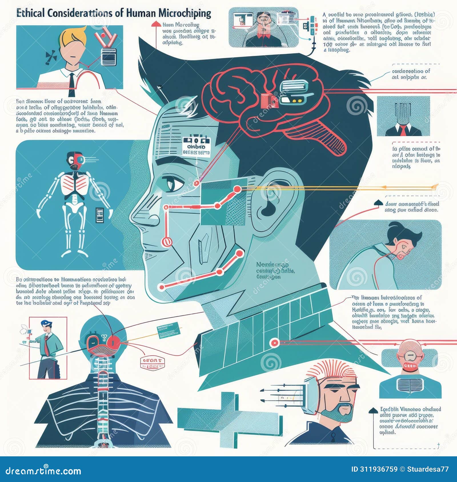Ethical Dilemmas of Human Microchipping Stock Image - Image of ...