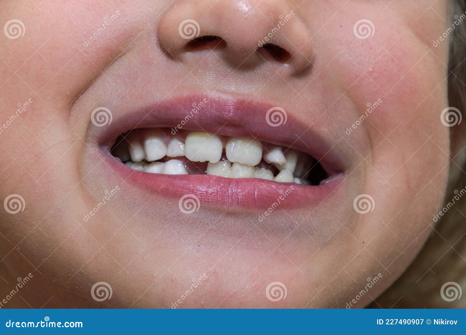 Ett Litet Barn Som Viftar Med Sin Tunga Och Som Borde Falla Ut ...