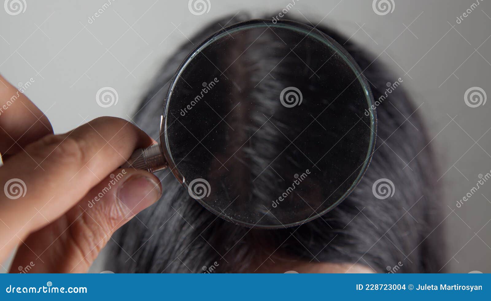 Examina El Pelo De Una Joven Con Una Lupa Foto de archivo - Imagen de ...