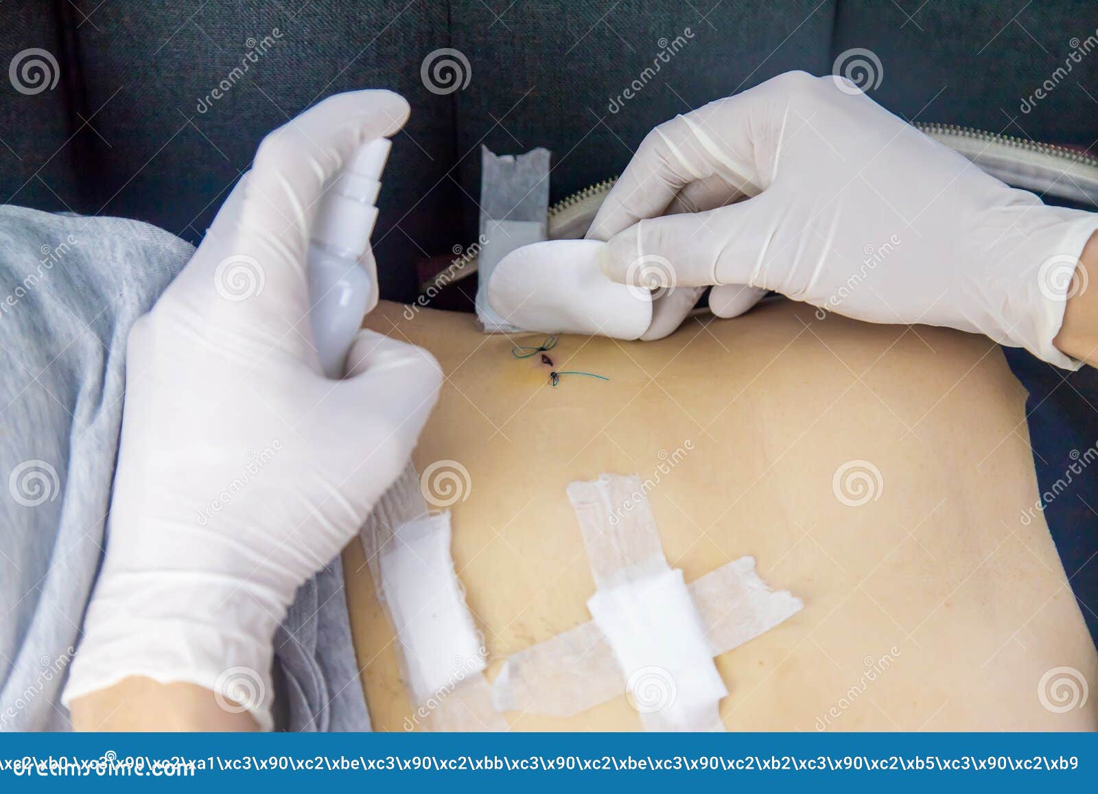 Examination of the Patient by a Doctor after Removal of the Appendix ...