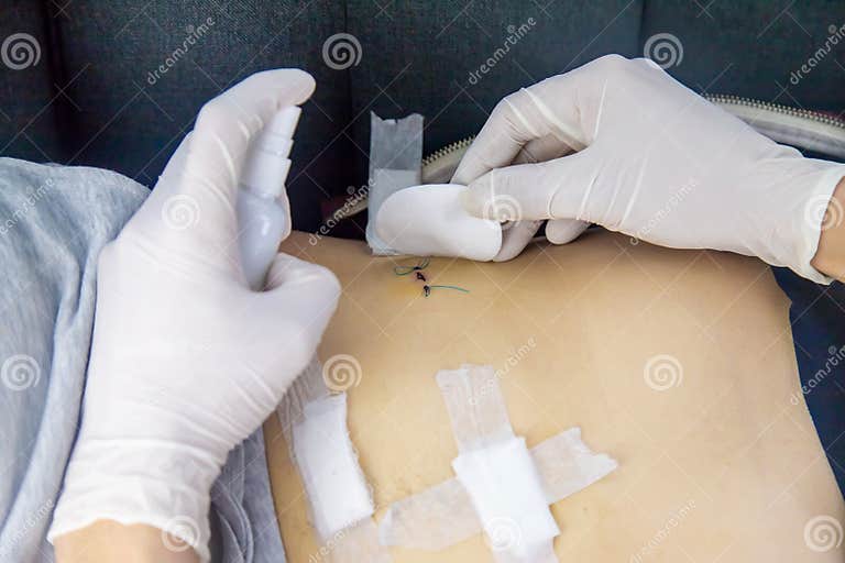 Examination of the Patient by a Doctor after Removal of the Appendix ...