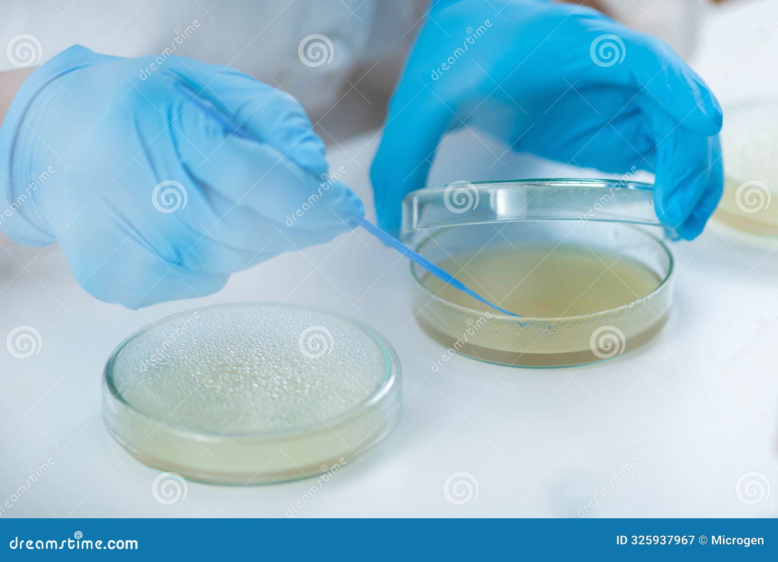Examining Bacterial Culture Plates in a Microbiology Lab Stock Image ...