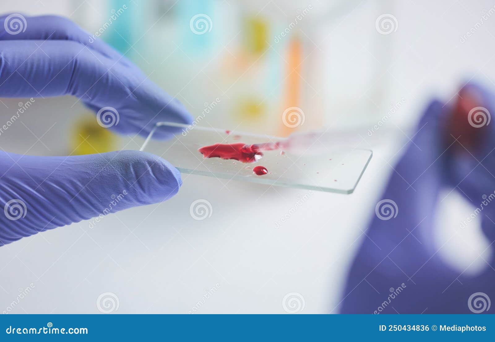 Examining Blood Sample on Microscope Slide Stock Photo - Image of ...
