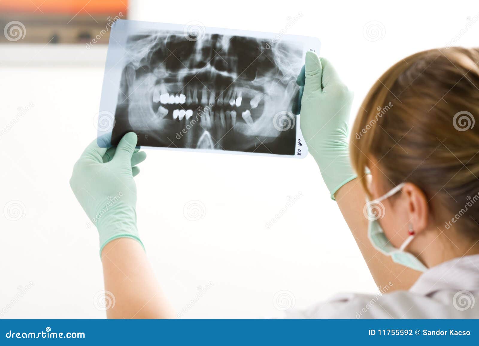 Examining radiography stock photo. Image of diagnostic - 11755592
