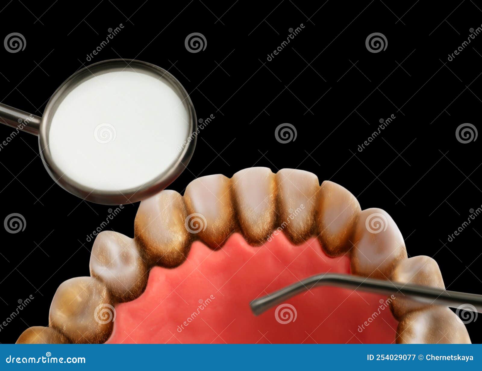 Black Calculus Teeth