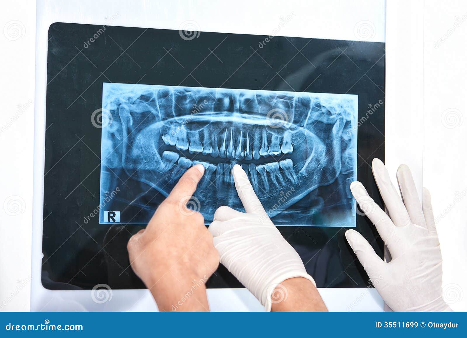 Examining teeth X Ray stock image. Image of clinic, rontgen - 35511699