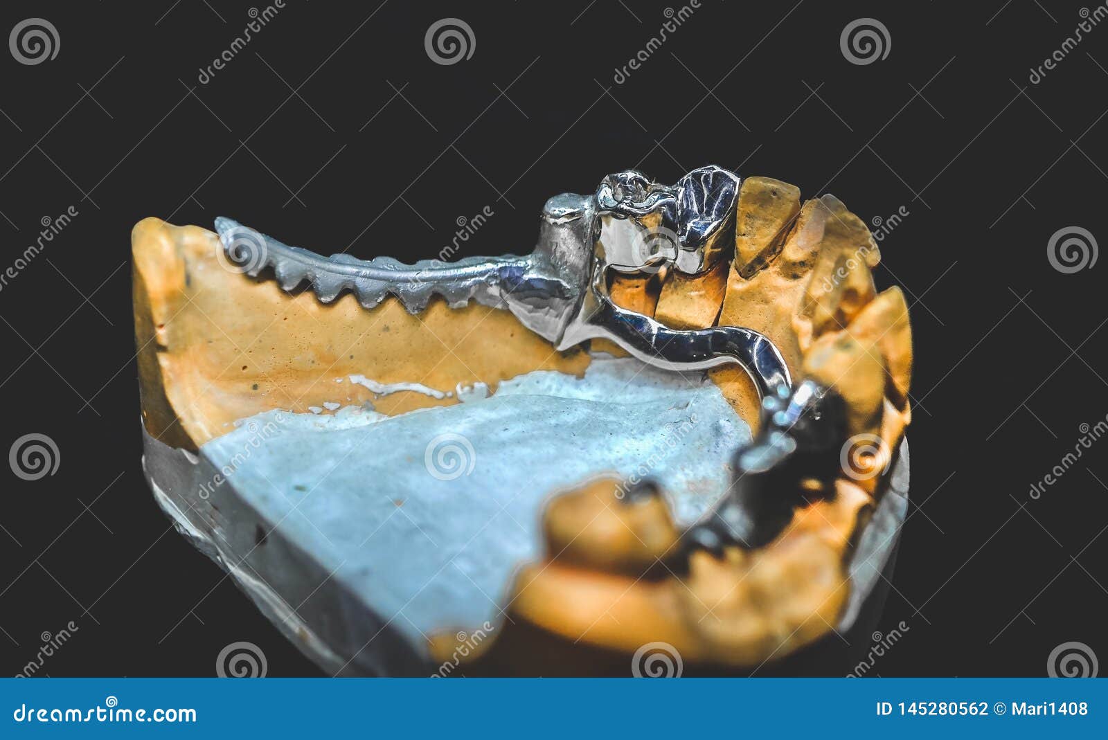 Example of a Bridge on an Artificial Human Jaw Stock Photo - Image of ...