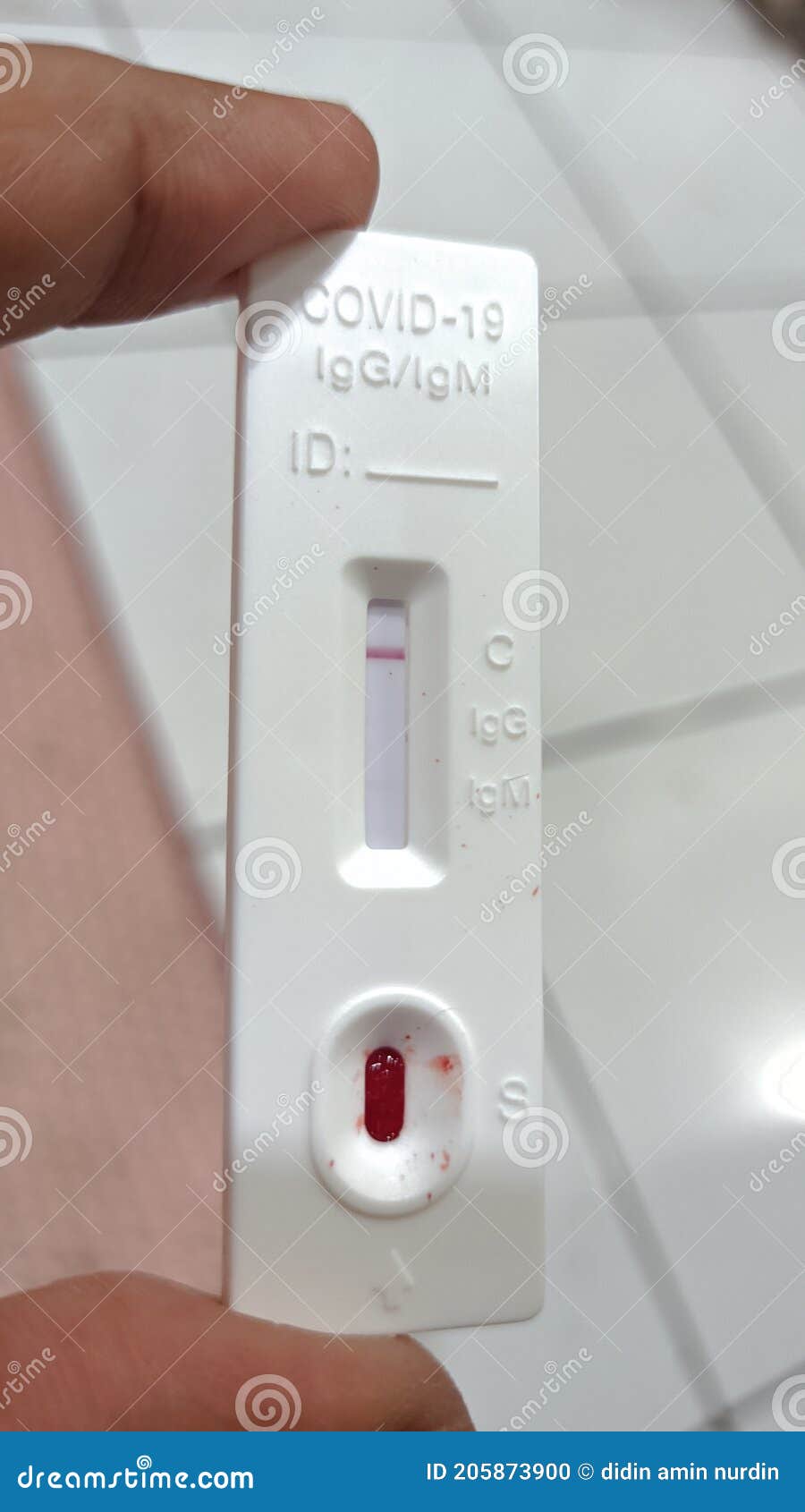 This is an Example of a Non-reactive Rapid Result Stock Photo - Image ...