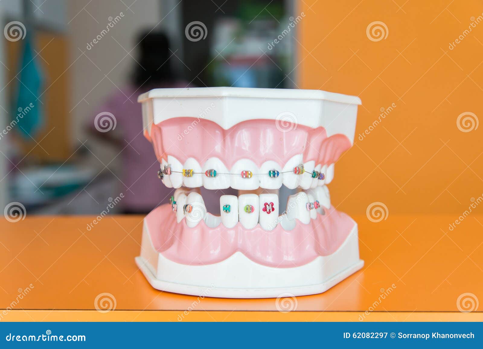 Examples braces stock image. Image of shiny, invisible - 62082297