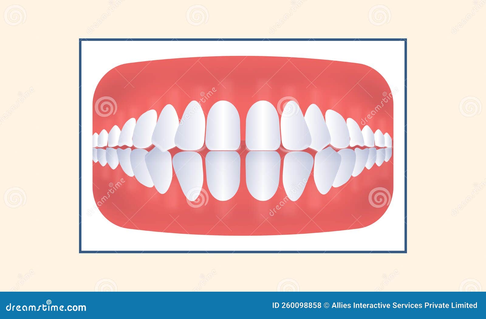 Spacing Teeth Diastema Vector Illustration | CartoonDealer.com #93804838