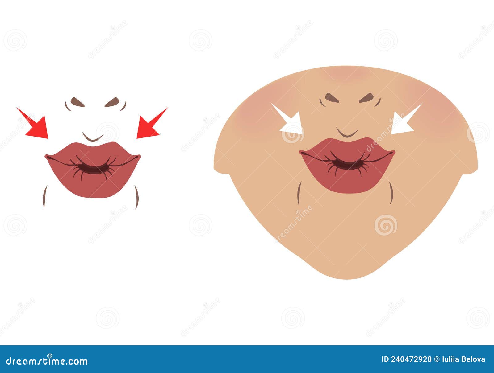Exercises for the Expression Muscles Around the Lips and Mouth ...