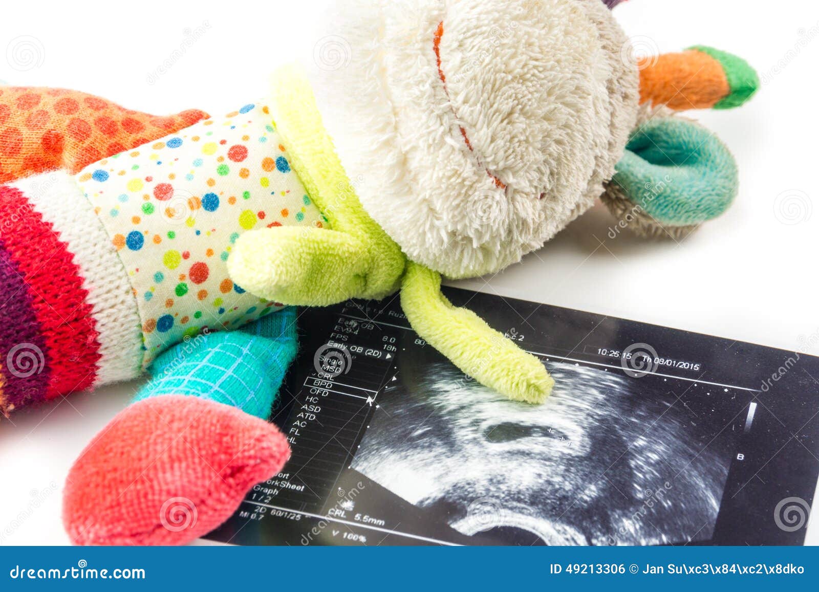 Expecting baby stock photo. Image of expecting, scan - 49213306