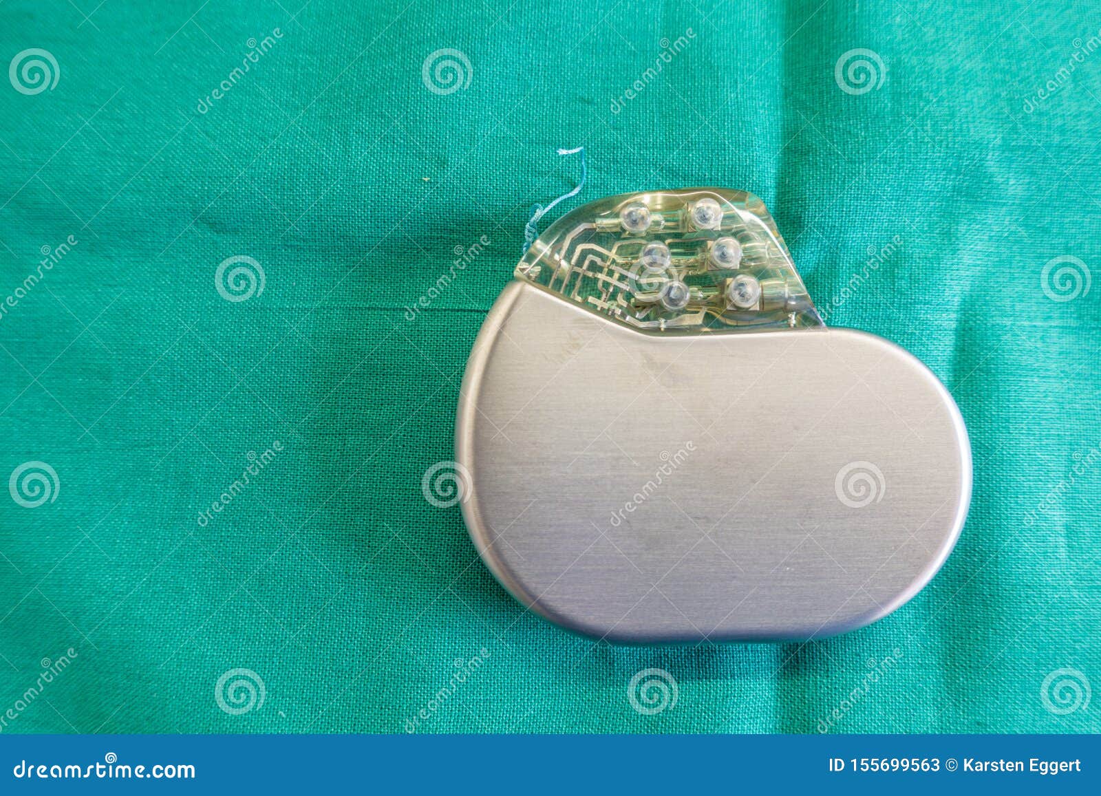 Explanted Defibrillator Lies on a Green Surgical Drape Stock Image ...