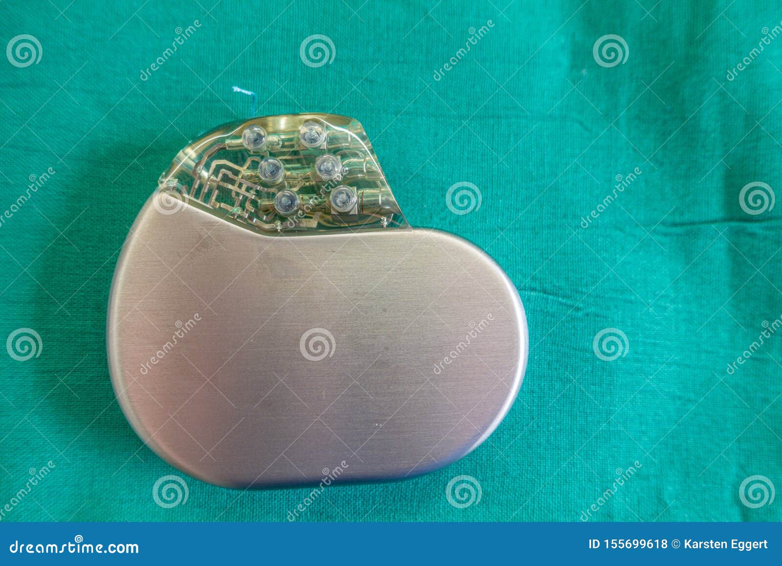 Explanted Defibrillator Lies on a Green Surgical Drape Stock Photo ...