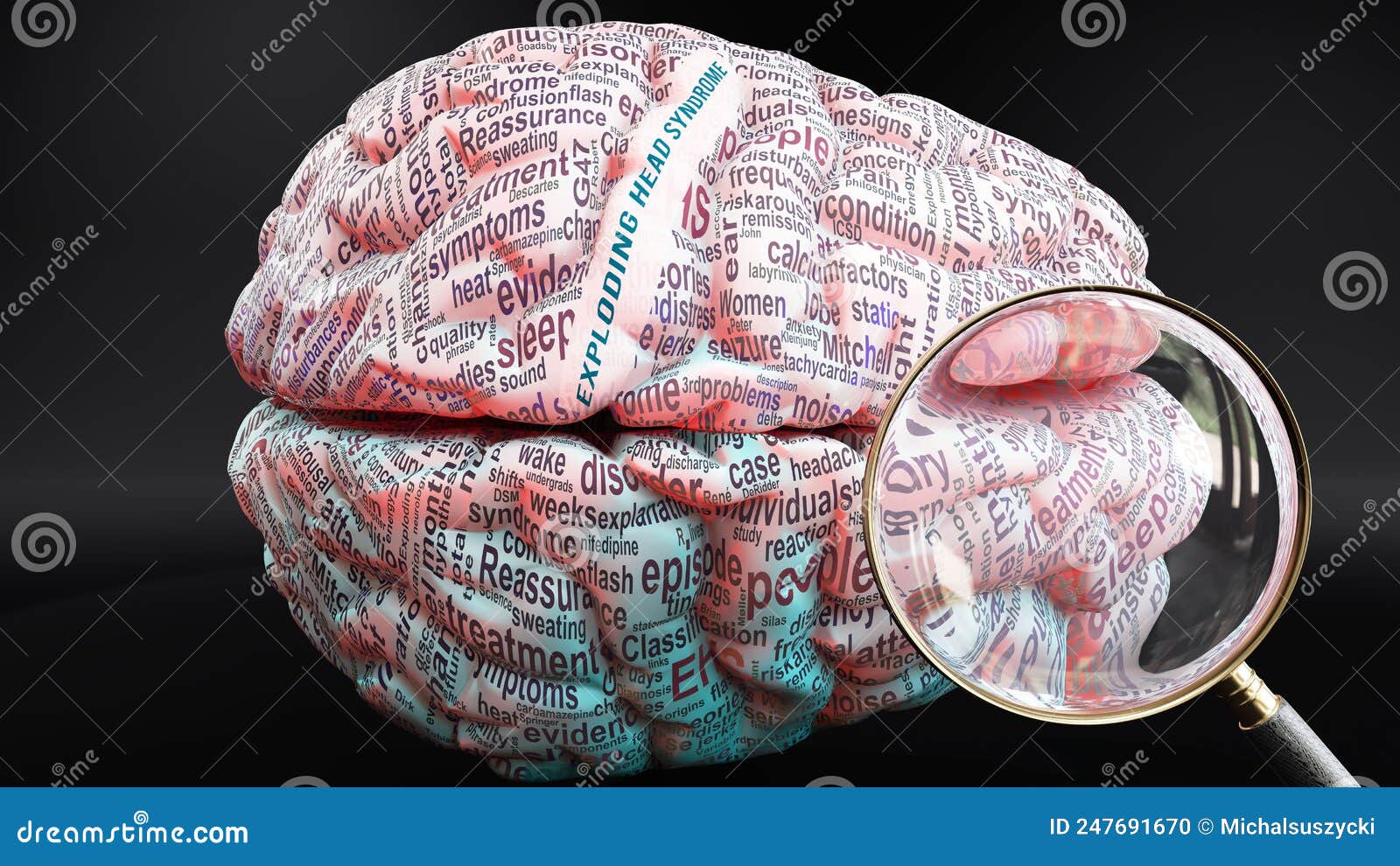 Exploding Head Syndrome in Human Brain Stock Photo - Image of exploding ...
