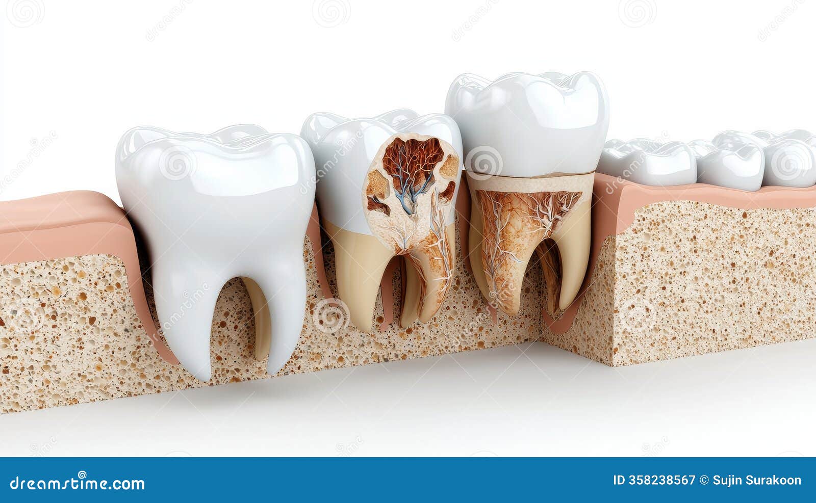 Exploring the Fascinating World of Teeth: a Comprehensive Examination ...