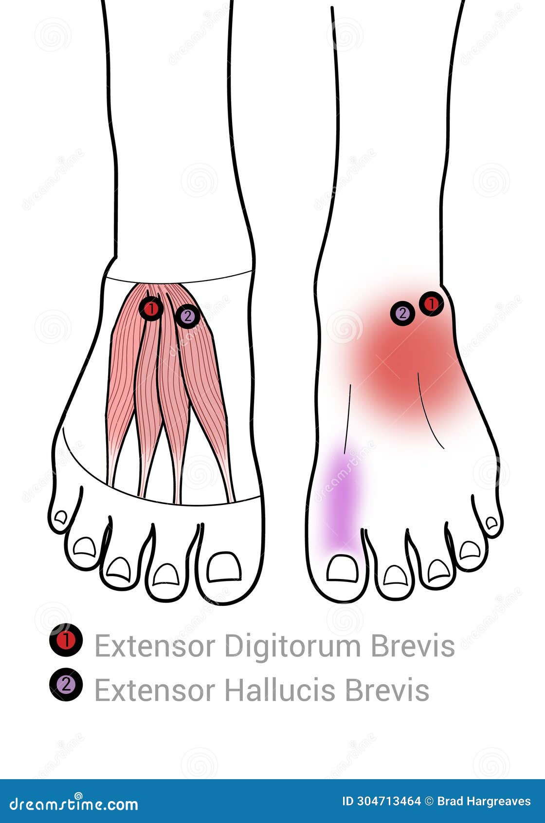 Extensor Digitorum Brevis and Extensor Hallucis Brevis Stock ...