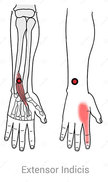 Extensor Indicis stock illustration. Illustration of muscular - 304713472