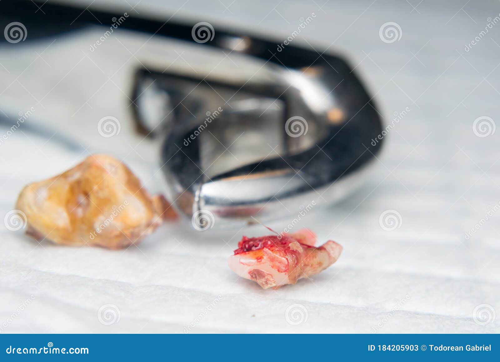 Extracted Dog Teeth and Extraction Pliers Close-up Stock Image - Image ...