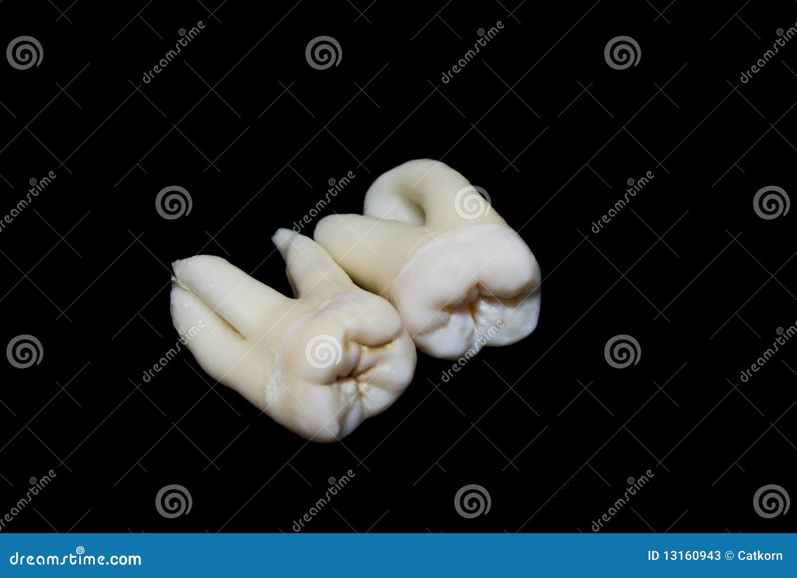 Extracted human teeth stock image. Image of bone, background - 13160943