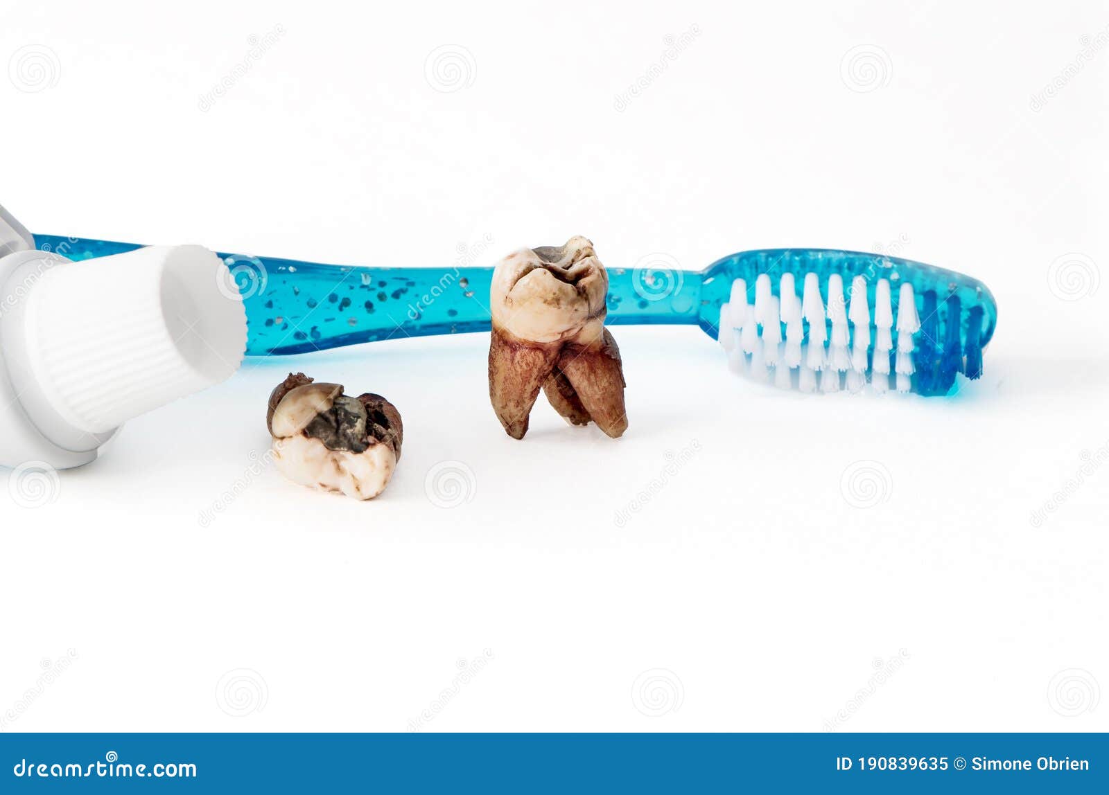 Extracted Molar Teeth with Caries Decay and Filling with Tooth Paste ...